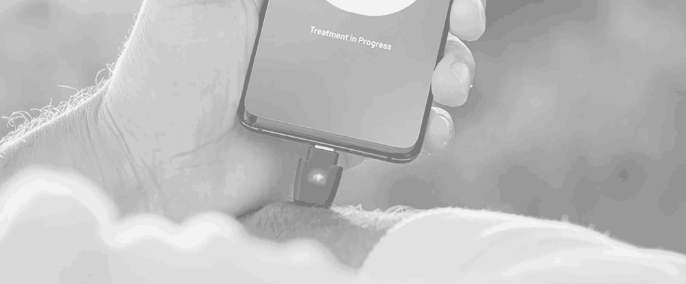 Heat-It: Because Removing Itches Is So Hot Right Now